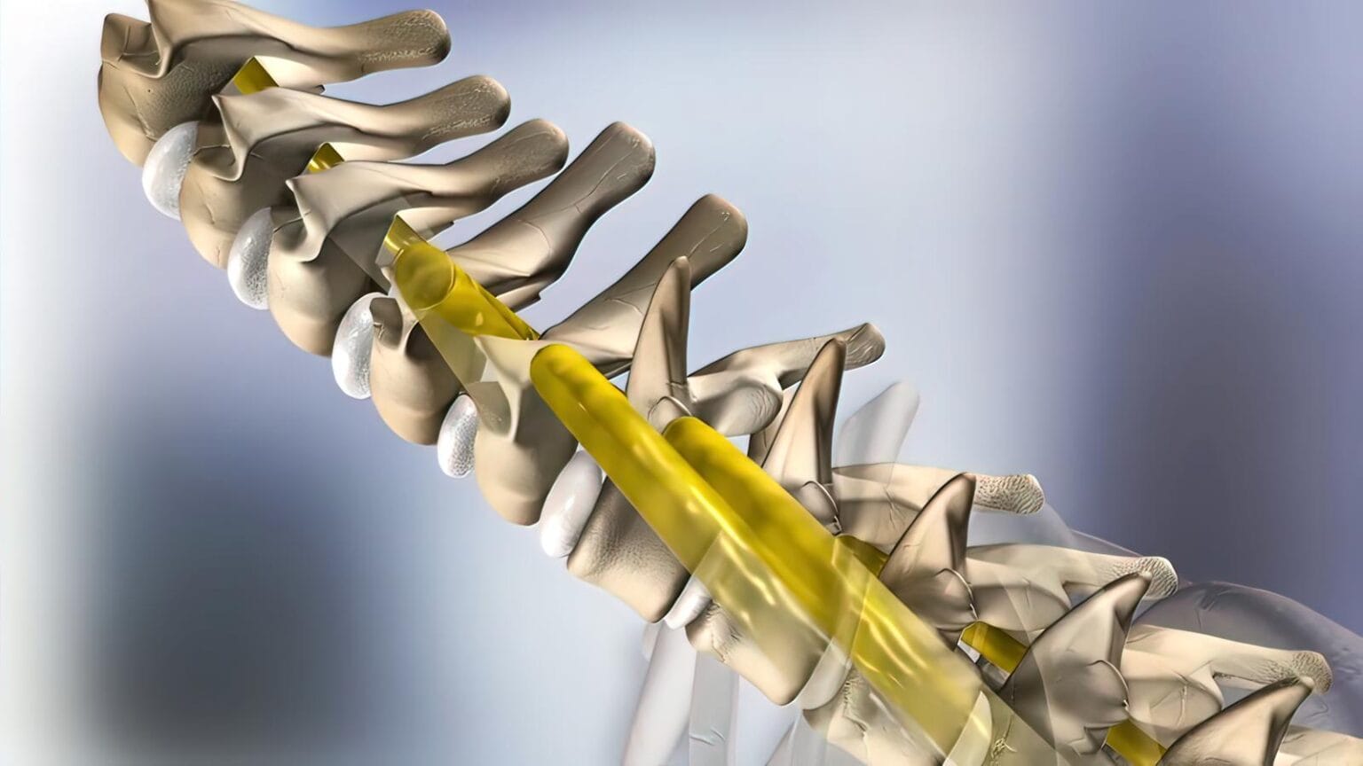 Chiropractor or Osteopath For Trapped Nerve | MHV Clinic