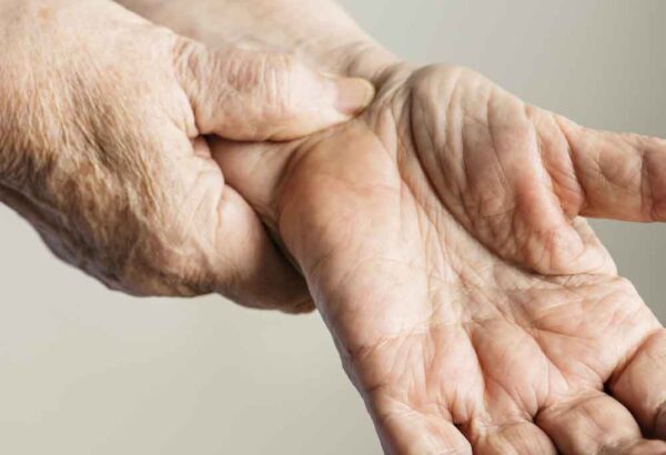 Arthritis Pain Relief Treatment In London | MHV Clinic