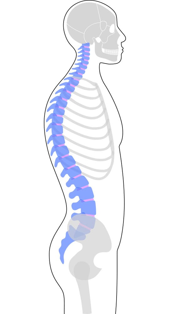 Types of Poor Posture | Osteopath In London | MHV Clinic