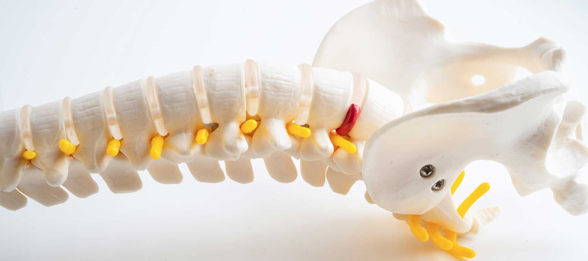 What Does a Herniated Disc Feel Like? | Symptoms and Treatment