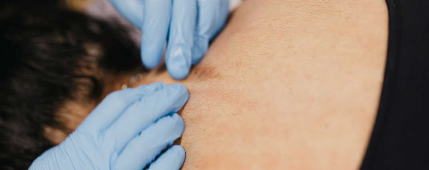 How an Osteopath Can Help Manage Chronic Back Pain | MHV Clinic