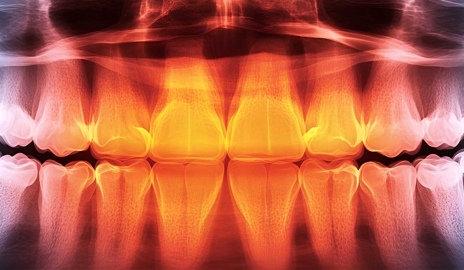 TMJ or Toothache: How to Tell the Difference | MHV Clinic